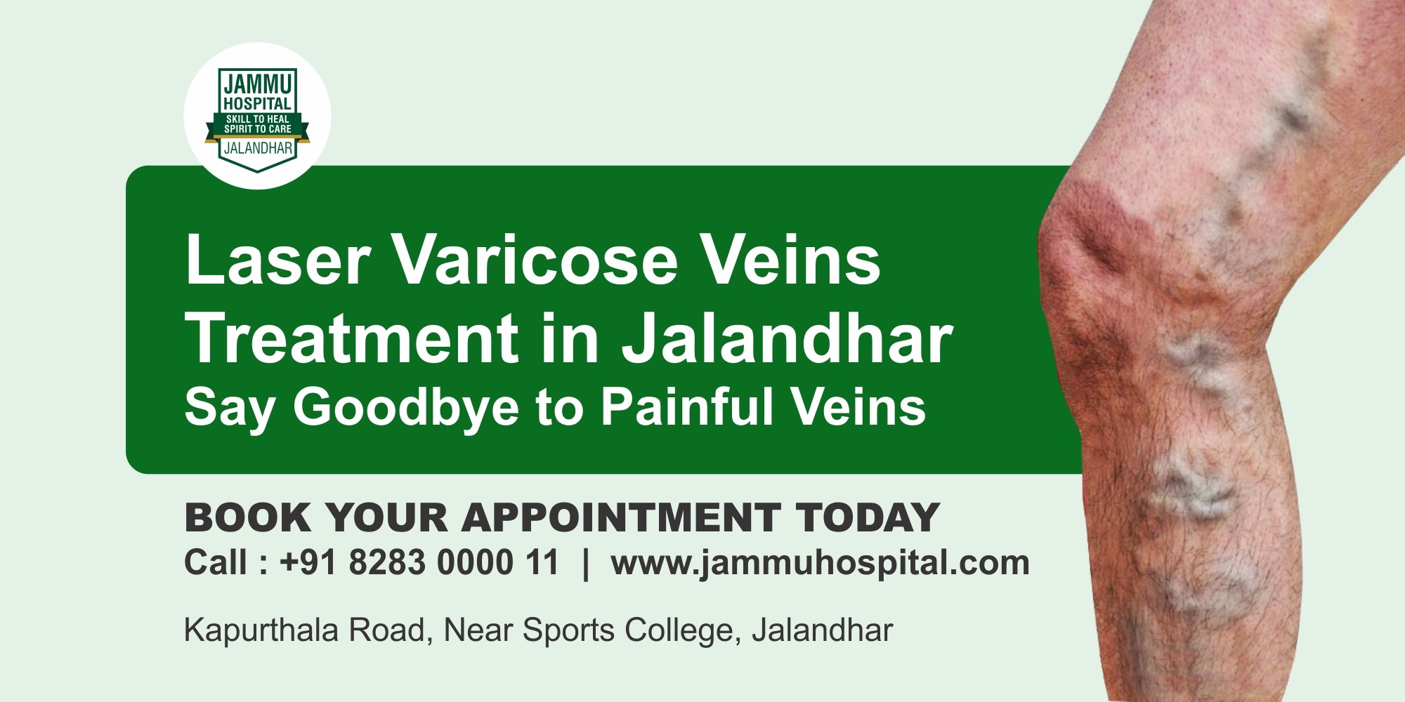 Laser Varicose Veins Treatment in Jalandhar - Say Goodbye to Painful Veins